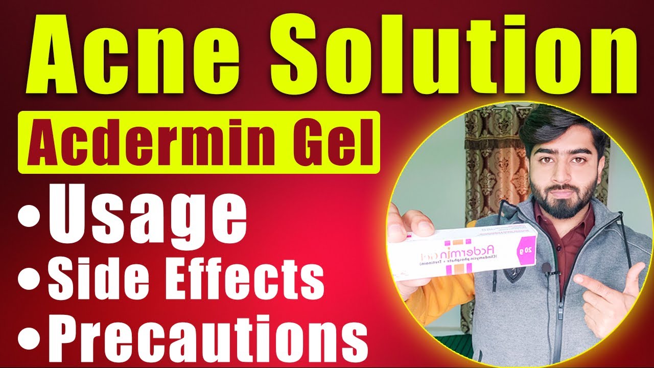 Best Gel For Acne Treatment | Pimple Solution | Acdermin Gel Use, Side ...