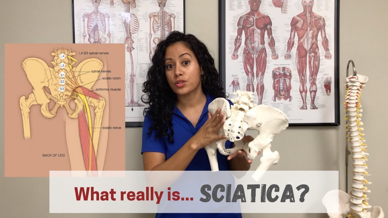 Sciatic Nerve Pain? What REALLY is sciatica? - YouTube
