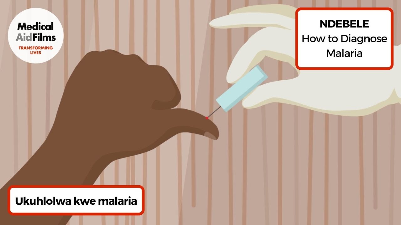 Ukuhlolwa kwe malaria - YouTube