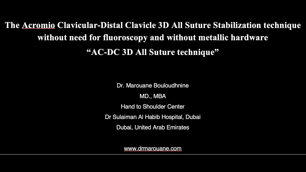 New technique for ACJ reconstruction AC DC 3D All Suture SD 480p - YouTube