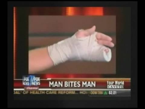 Man Gets Finger Bitten Off At Healthcare Rally - YouTube