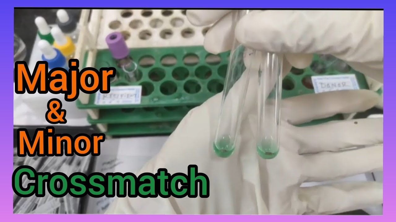 Major & Minor Crossmatch Test Procedure || Compatibility Test ||Blood ...