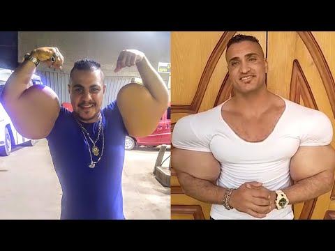 Biggest Synthol Freaks Of 2023 | Best Oil Guys Of 2023 #24