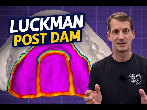 The Luckman Post Dam Technique (Digital Workflow In Exocad) | Overview of Technique