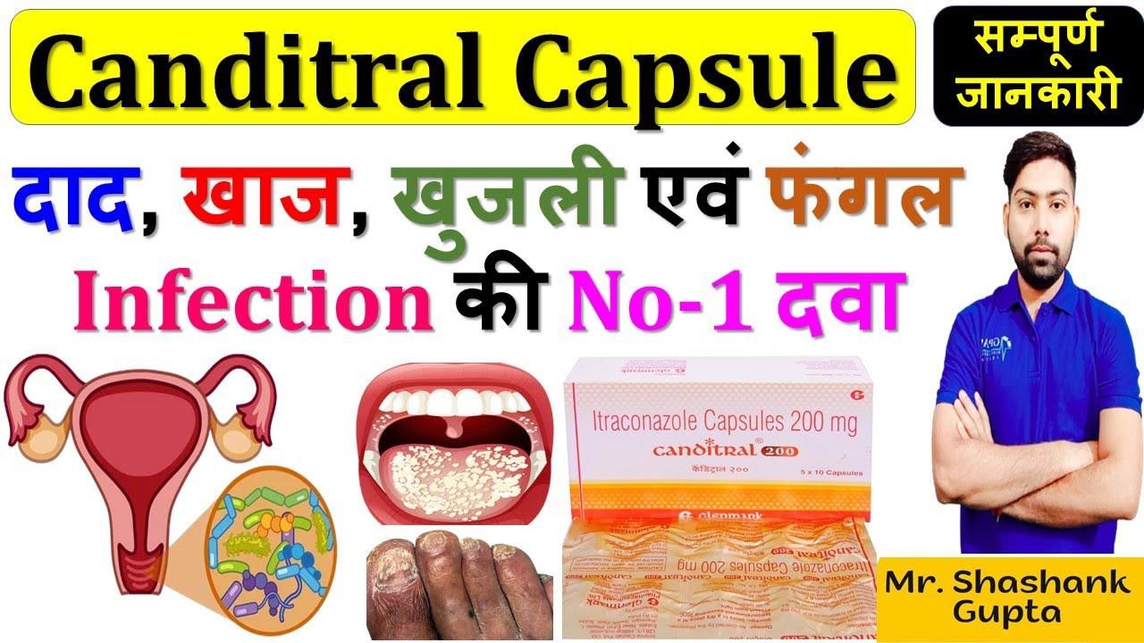 Canditral Capsule की सम्पूर्ण जानकारी |दाद, खाज, खुजली एवं फंगल ...