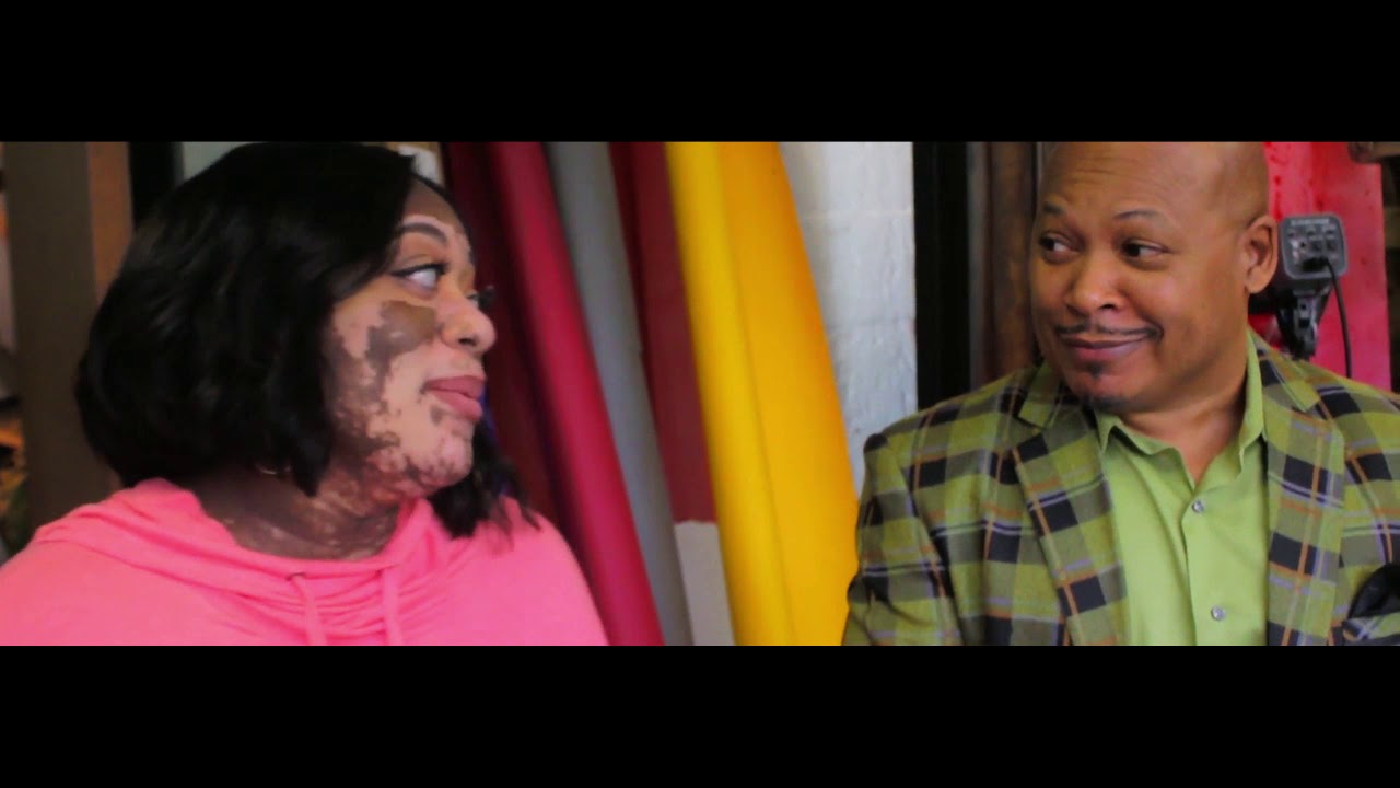 "The Skin I'm In" - FERRELL PHELPS talks VITILIGO with model Kandice ...