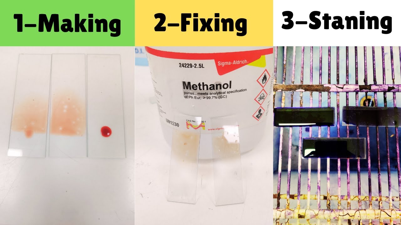 Peripheral Blood smear in 3 steps I Hematology test I Blood smear - YouTube