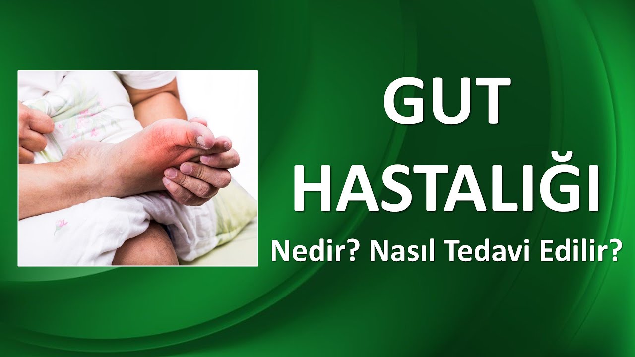 GUT HASTALIĞI Nedir, Nasıl Tedavi Edilir? - YouTube