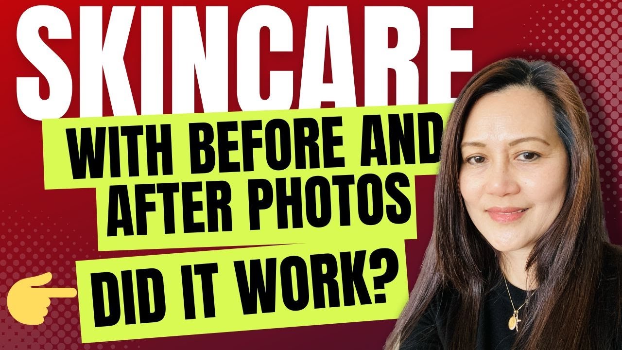 Riman Skincare Testimonials with Before and After Photos - YouTube