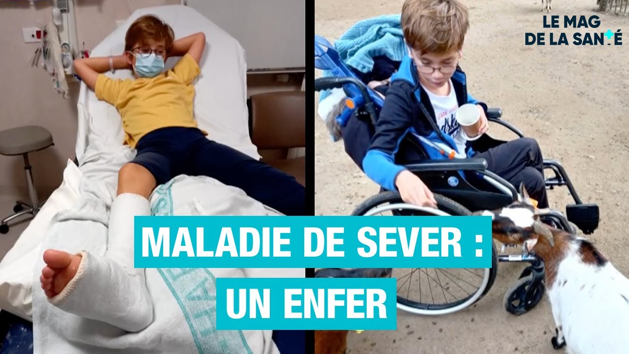 La maladie de SEVER chez les enfants 👦 - Allo Docteurs - YouTube
