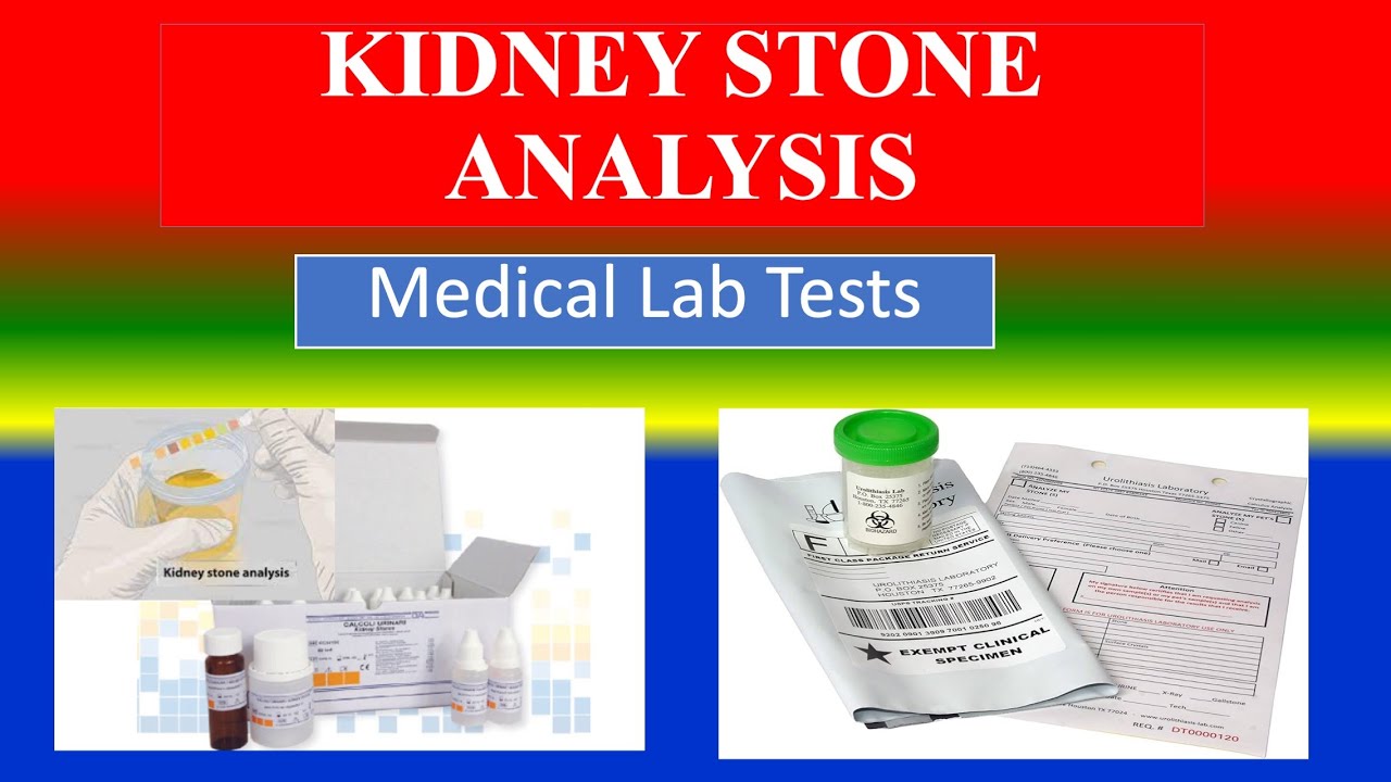 KIDNEY STONE ANALYSIS TEST - Medical Lab Tests - What is ? , Uses ...