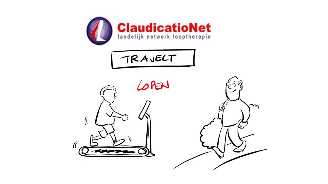 Etalagebenen (claudicatio intermittens) informatievideo De Rooy ...
