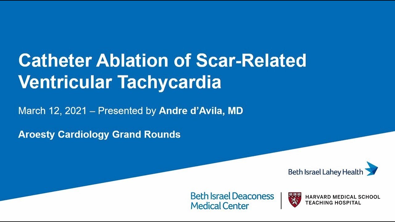 Catheter Ablation of Scar-Related Ventricular Tachycardia by Andre d ...