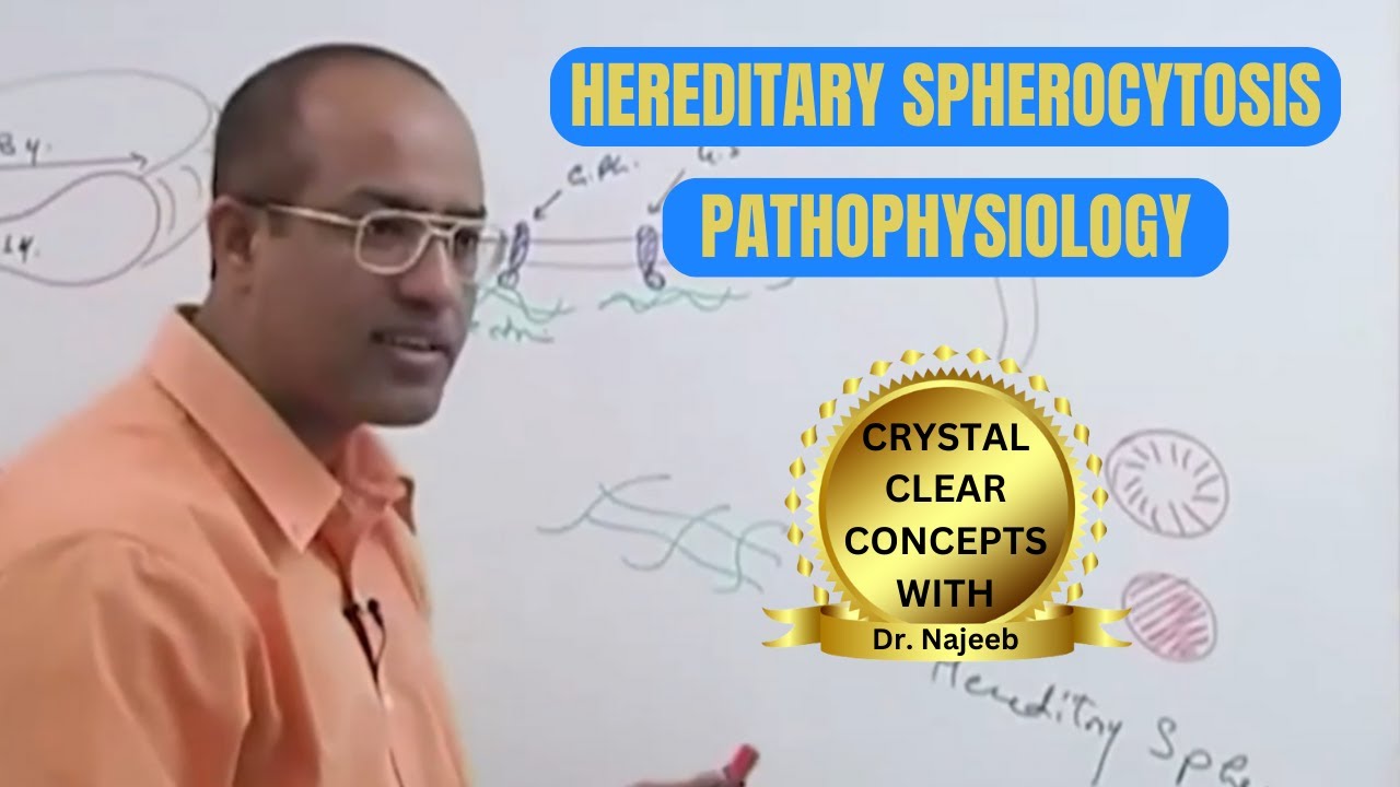 Hereditary Spherocytosis | Anemia | RBCs | Pathophysiology 🩺 - YouTube