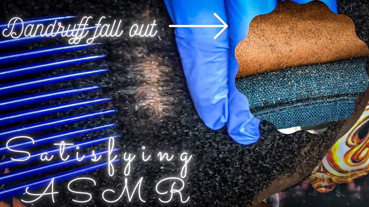 ASMR To Help You Sleep | Dandruff removal ️| Scalp Scratching | No ...