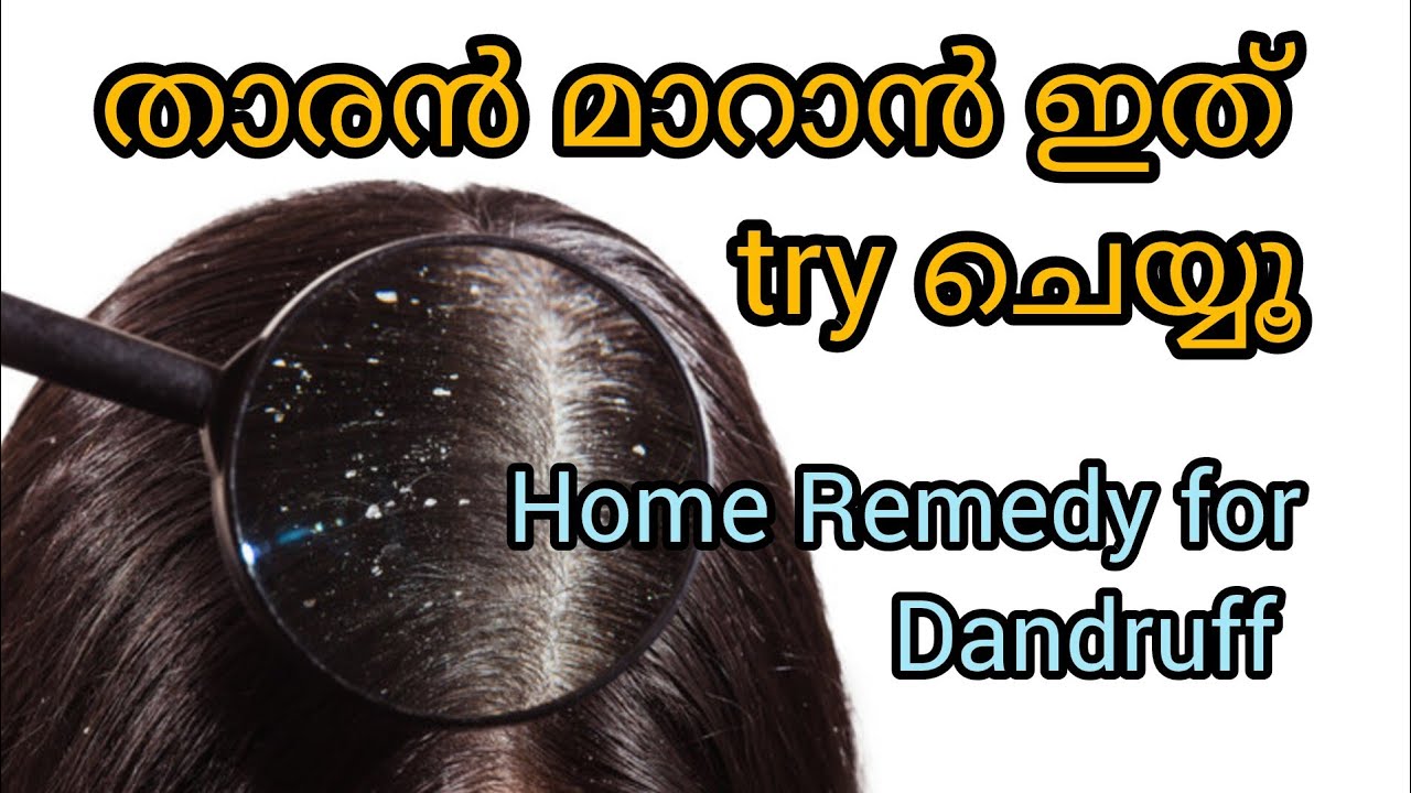 How to cure dandruff permanently naturally at home | AJsimplytalks | # ...
