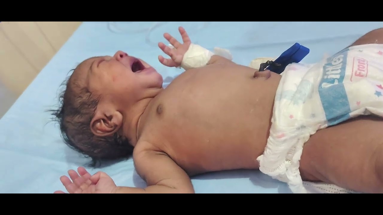 New Born Baby Lscs Very cute Baby Video ll Cry baby videos Hospital in ...