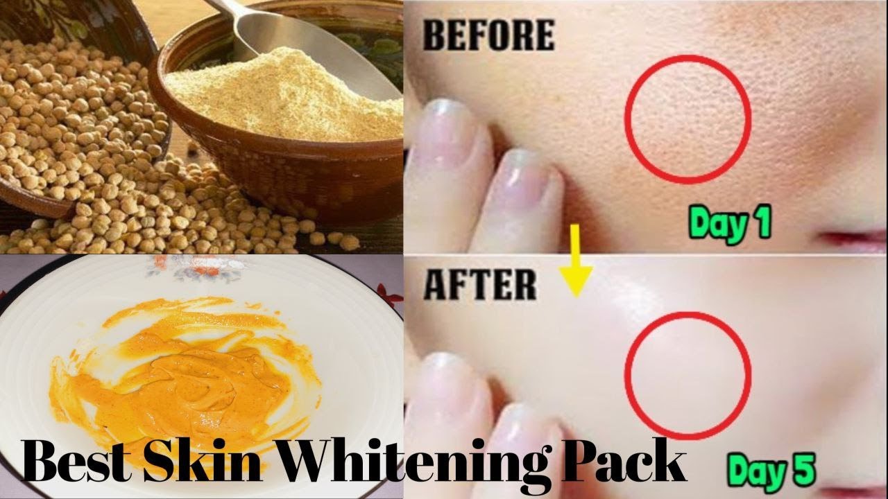 DIY Gram Flour pack at home for skin whitening/ Treat pigmentation,dark ...
