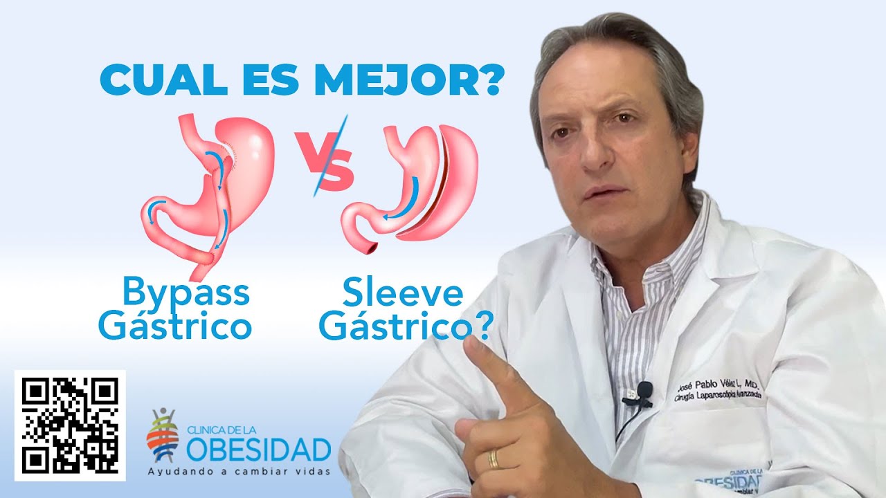 Bypass gástrico o Sleeve gástrico ¿Cual es mejor? - YouTube