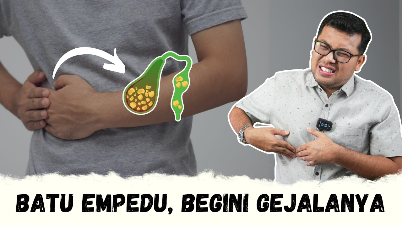Gejala batu empedu yang sering tidak di sadari- DOKTER SADDAM ISMAIL - YouTube