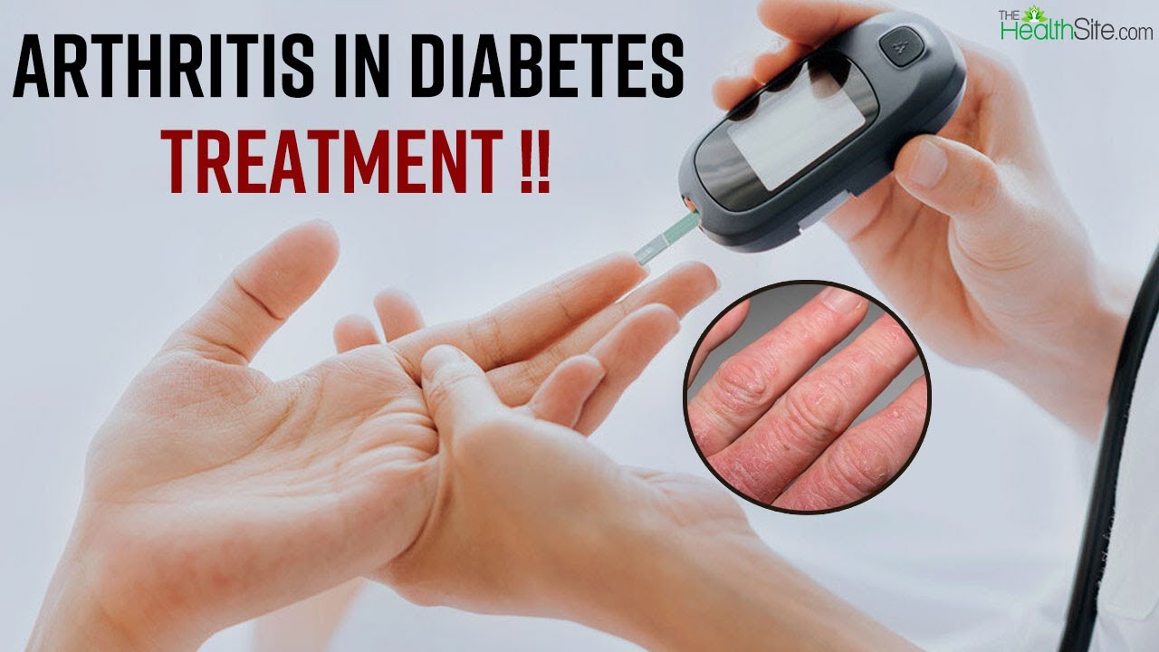 Know How To Manage Arthritis When You Have Diabetes || The Health Site ...