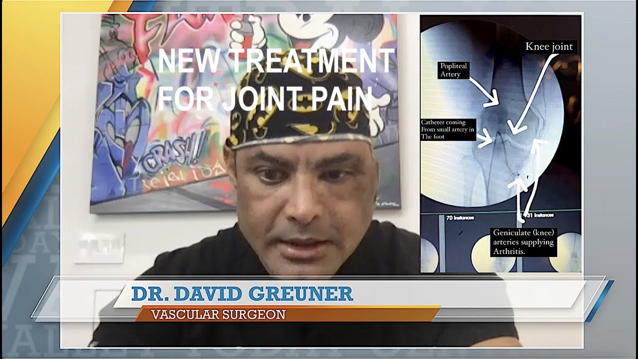 Dr. David Greuner Explains No Knife Procedure For Joint Pain Relief ...