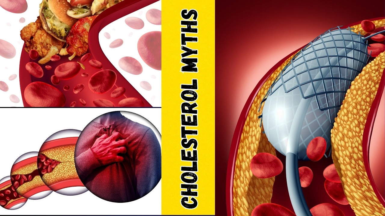 🧀 Cholesterol Myths Busted: What You Need to Know - YouTube