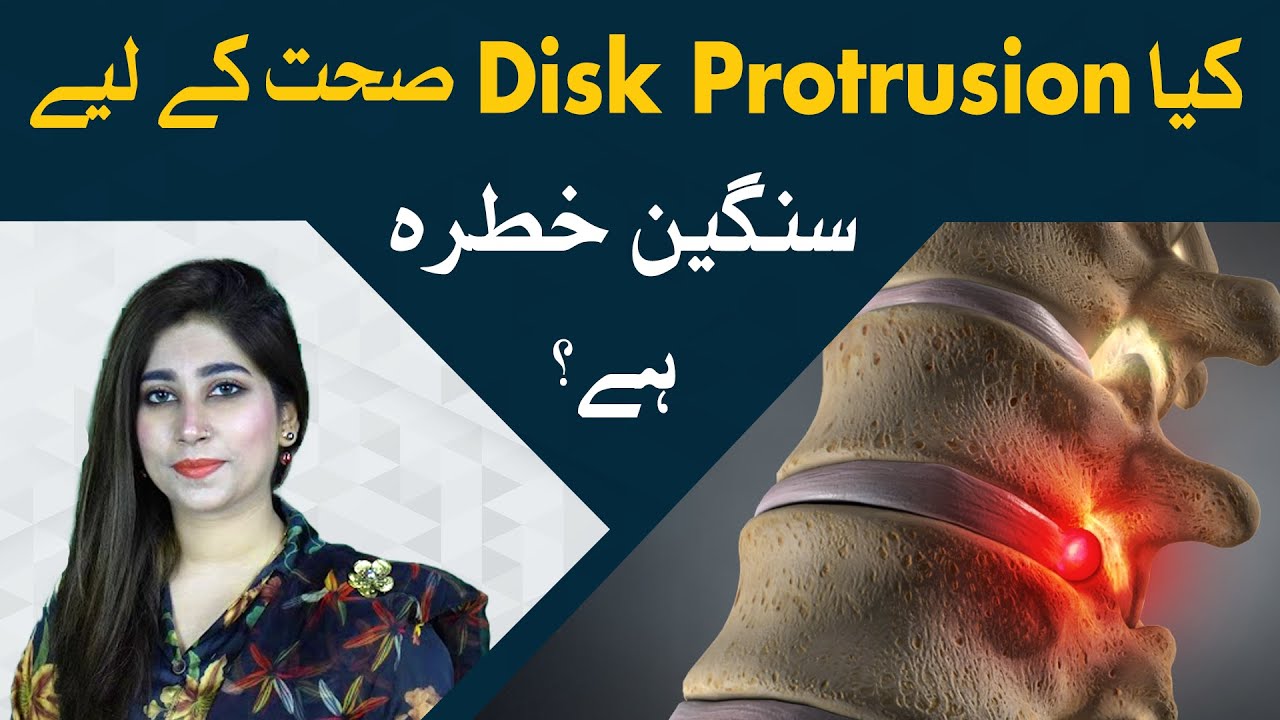 What is Disk Protrusion in Back Pain? | Disk Protrusion kya hai? - YouTube