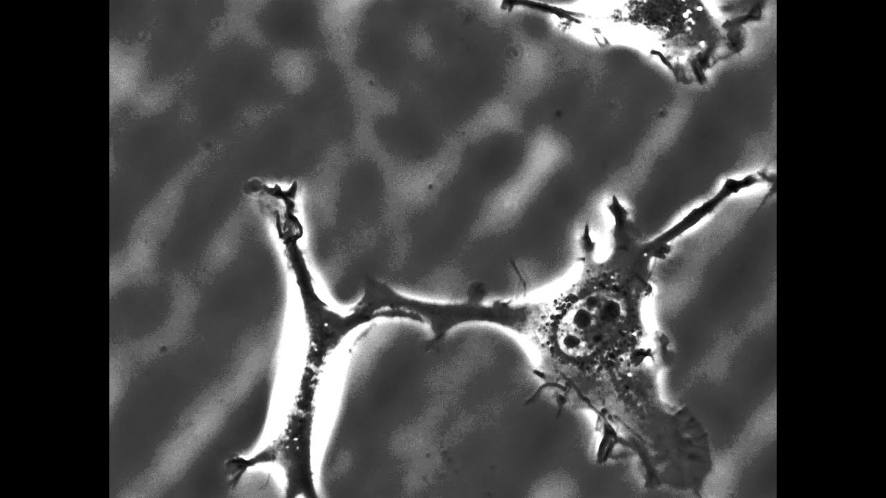 3T3 fibroblasts 40x Movie - YouTube