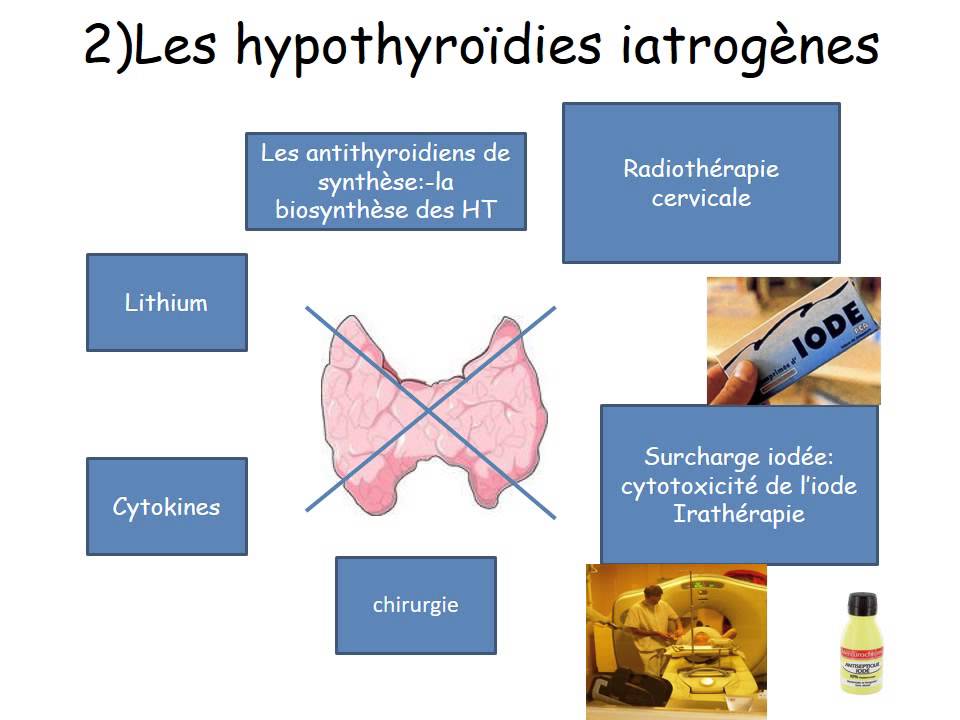 ENDOCRINOLOGIE Les hypothyroïdies - YouTube