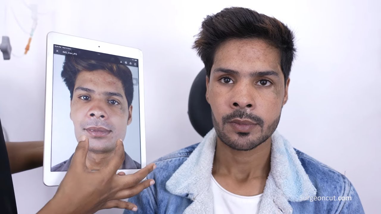 Plastic Surgery Miracle for this Man by Dr. Sunil Richardson - YouTube