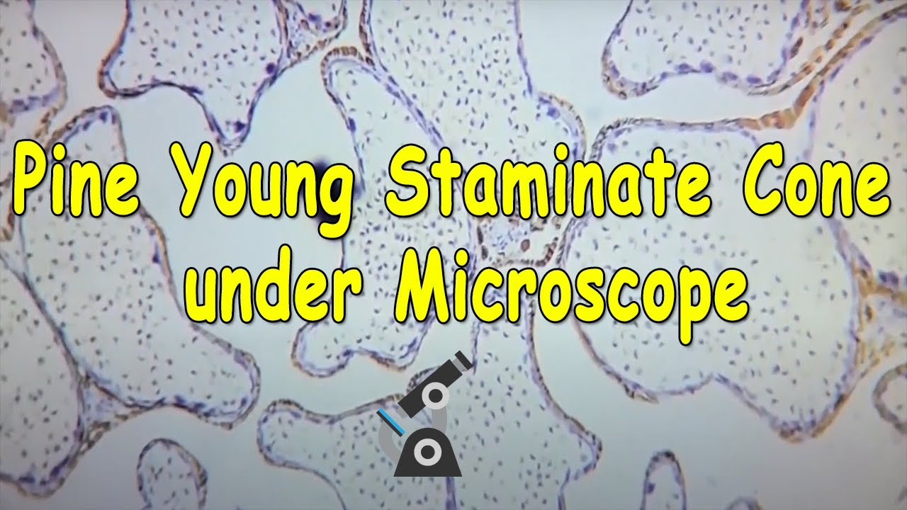 Pine Young Staminate Cone under Microscope - YouTube