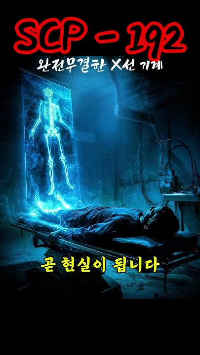 scp-192 완전무결한 X선 기계 - YouTube