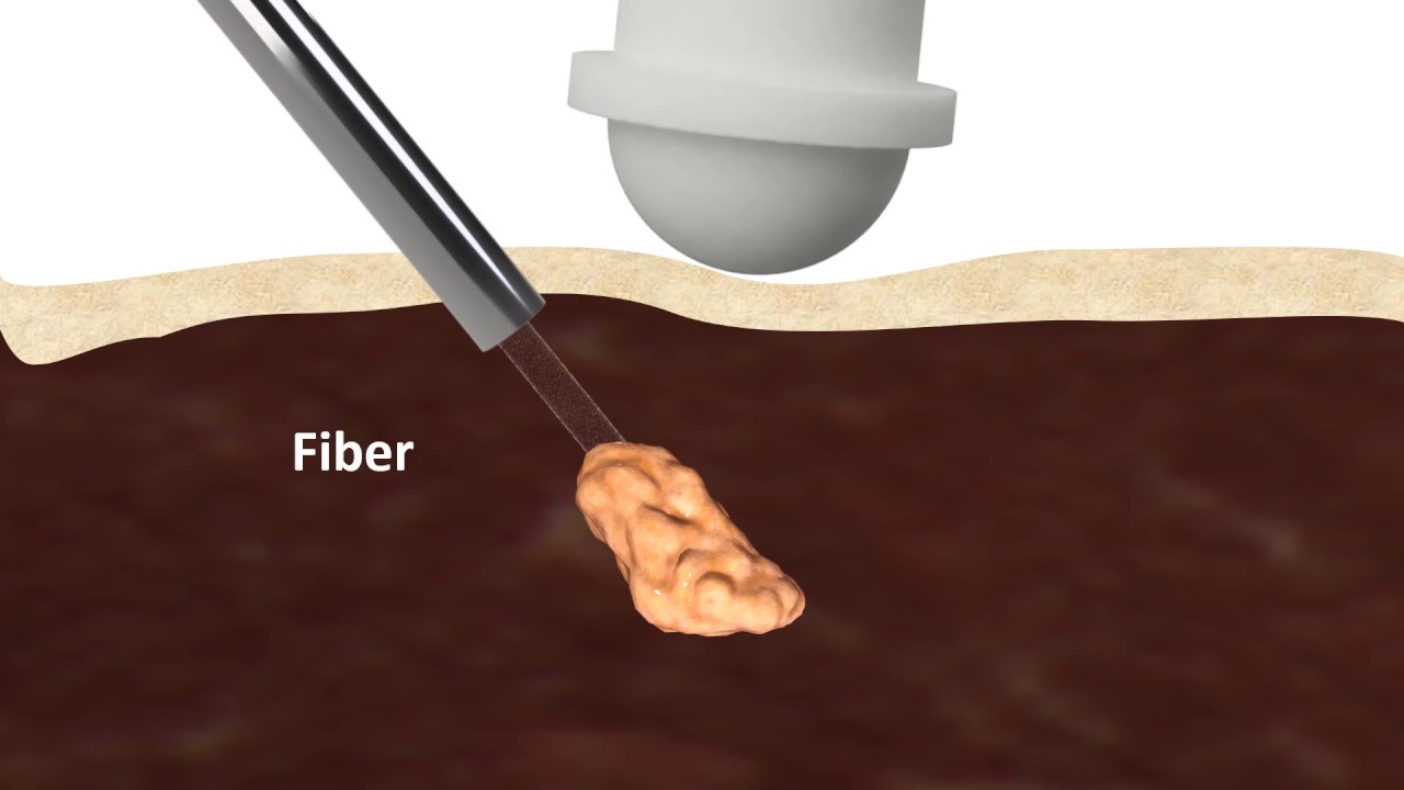 Lab-on-Fiber GmbH - YouTube