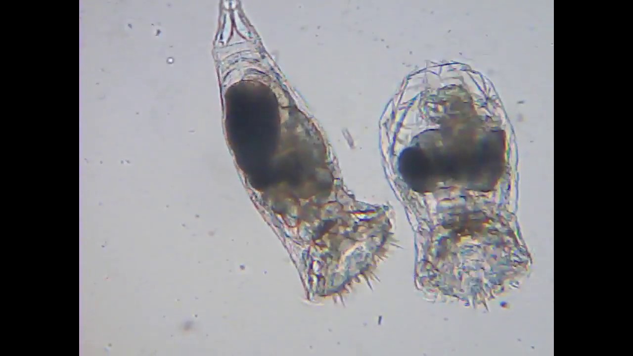 A happy family of rotifers Epiphanes senta - YouTube