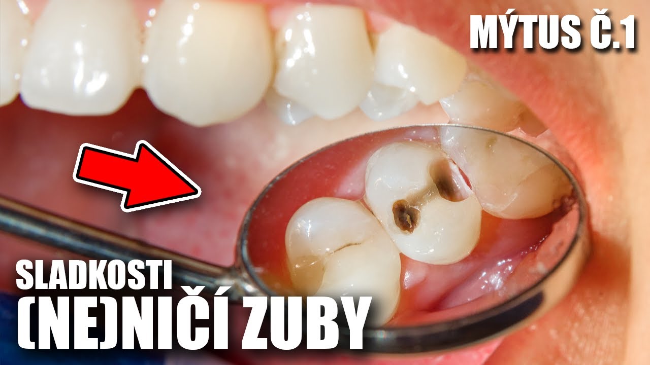 Nejčastější mýty o zubech a péči o chrup - YouTube