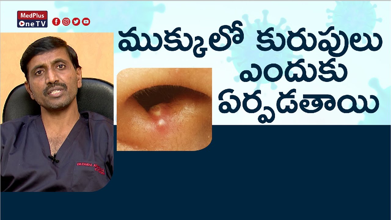 Why to Pimples Form Inside Nose Here Are The Reasons l Dr. Chava ...