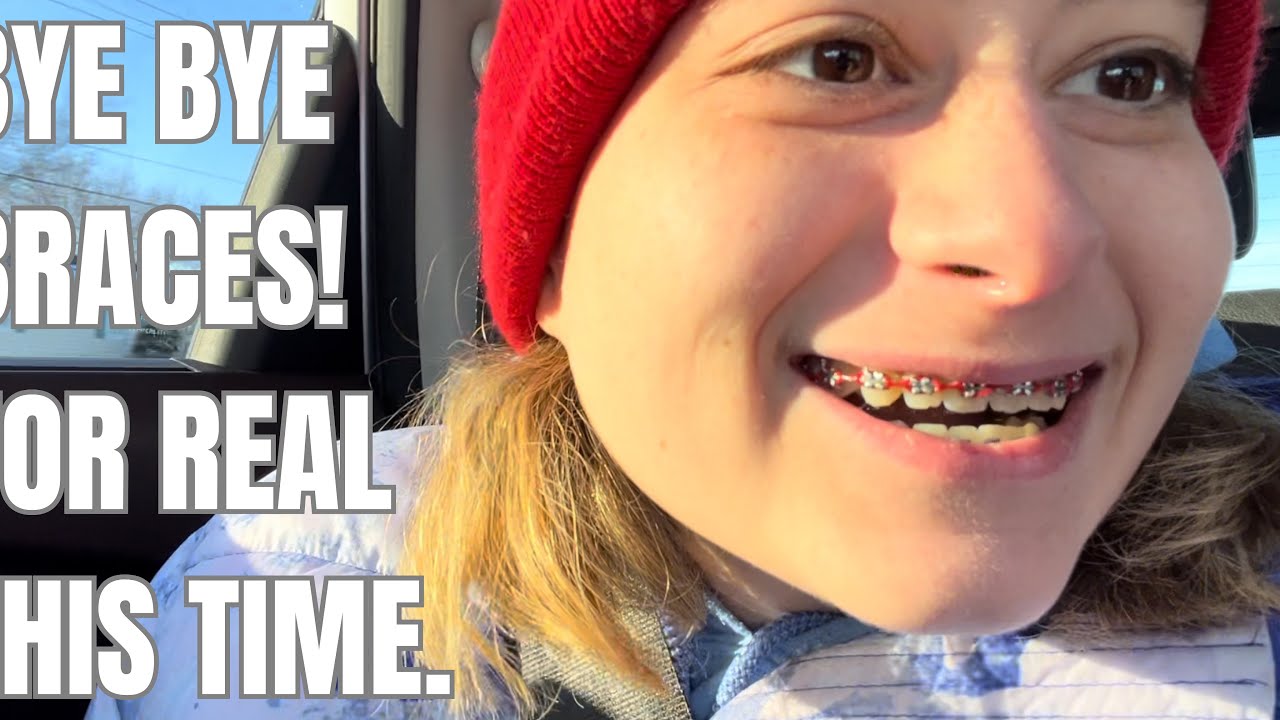 Bye bye braces for Real this time! - YouTube