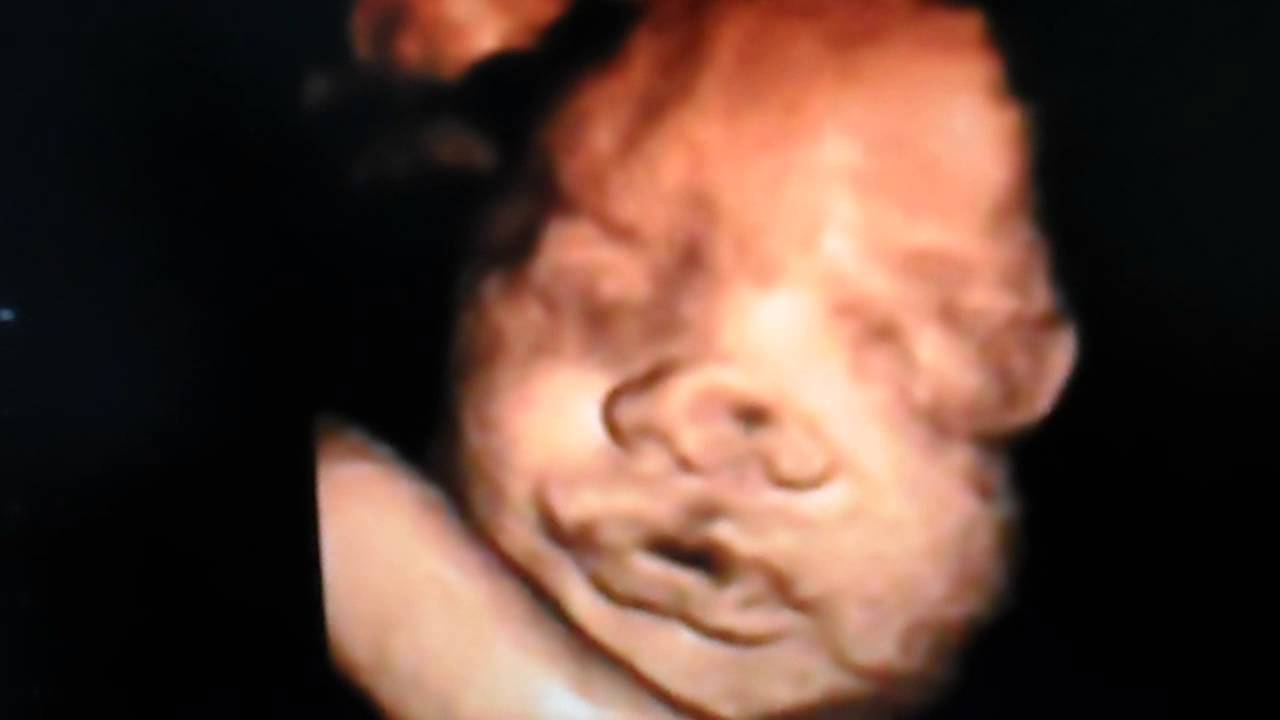 33 semanas de embarazo - YouTube