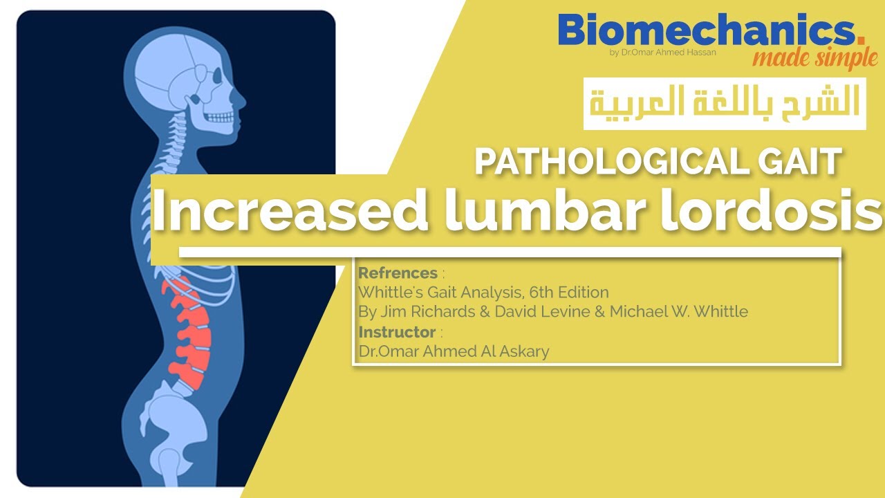 Pathological gait (Increased lumbar lordosis) - Biomechanics made ...