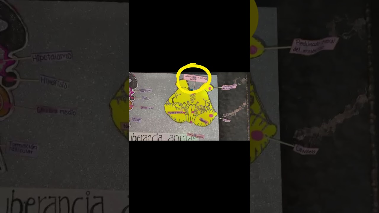 PROTUBERANCIA ANATOMÍA🧠 - YouTube