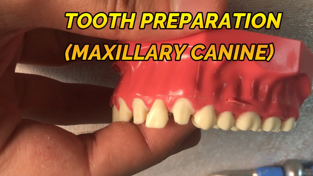 CROWN PREPARATION TUTORIAL (MAXILLARY CANINE) - YouTube