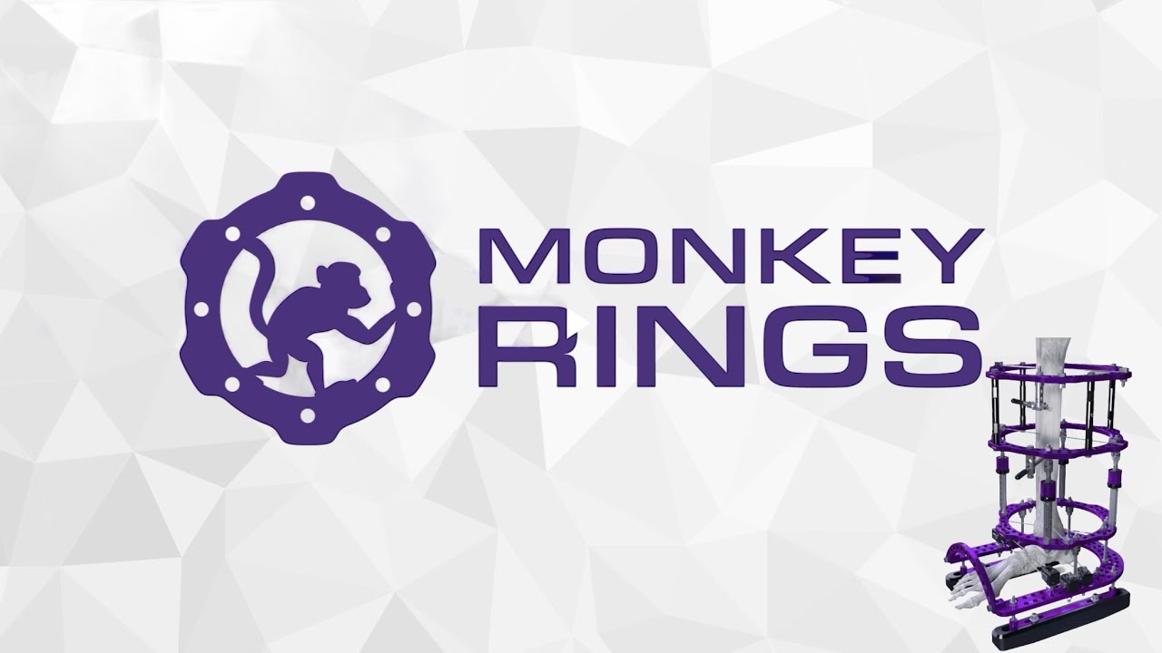 Paragon28 Monkey Rings Circular External Fixation System ANIMATION ...