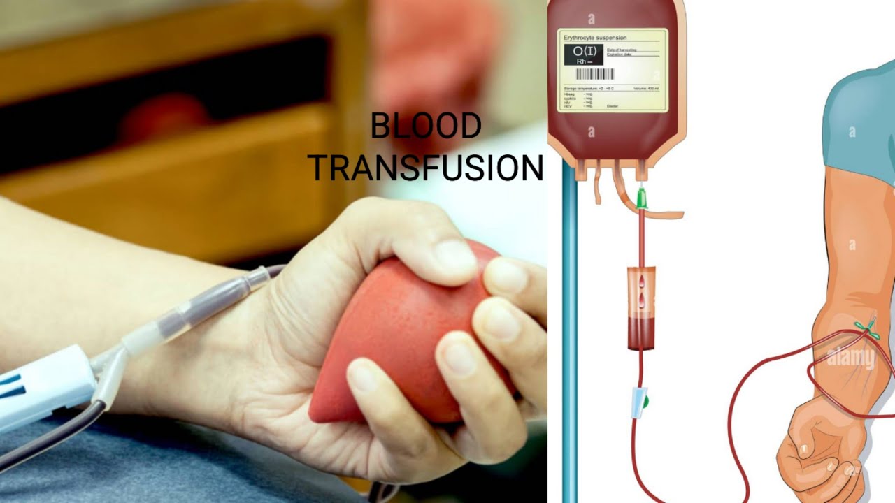 blood transfusion #medicine #viva #mbbs - YouTube
