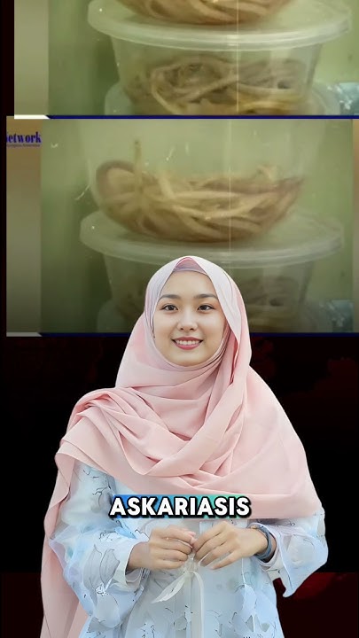 Viral ! Anak Di Jember Perutnya Penuh Cacing dan Tidak Bisa BAB | Info Berita Viral terbaru ...