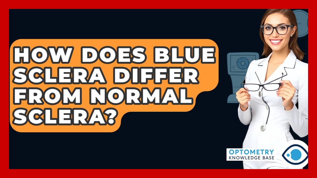 How Does Blue Sclera Differ From Normal Sclera? - Optometry Knowledge ...