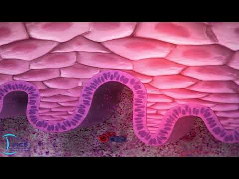 Menapozda Vajinal Kuruluk,İdrar Kaçırma Ve Cinsel Problemlerde Lazer tedavisi