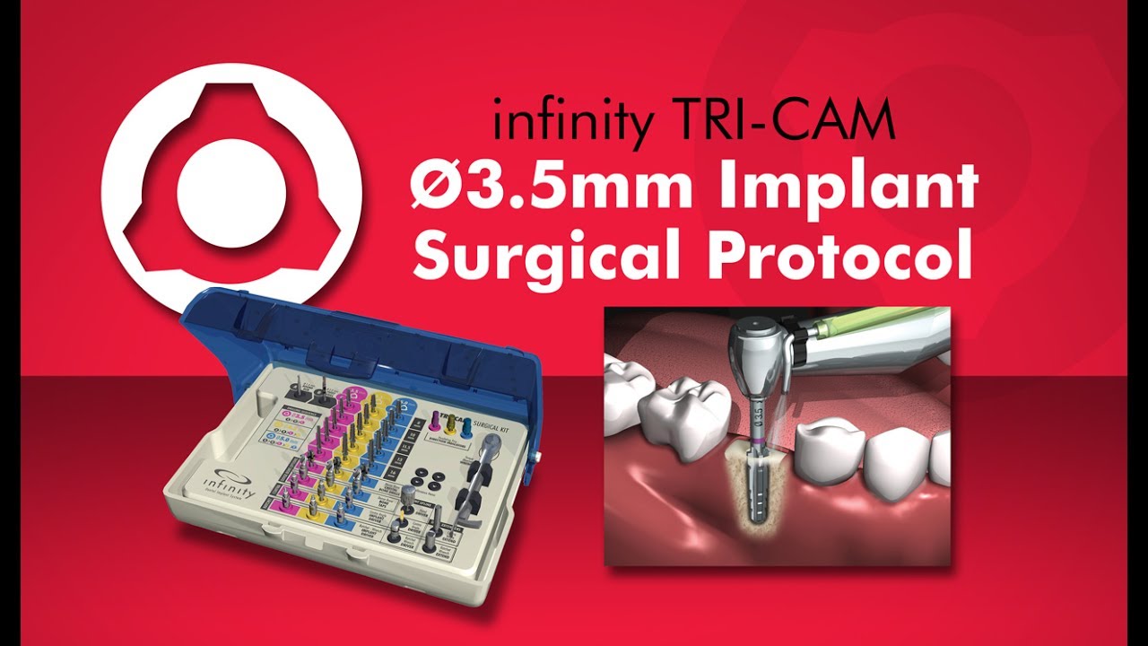 infinity TRI-CAM 3.5mm Platform implants - Surgical Protocol - YouTube