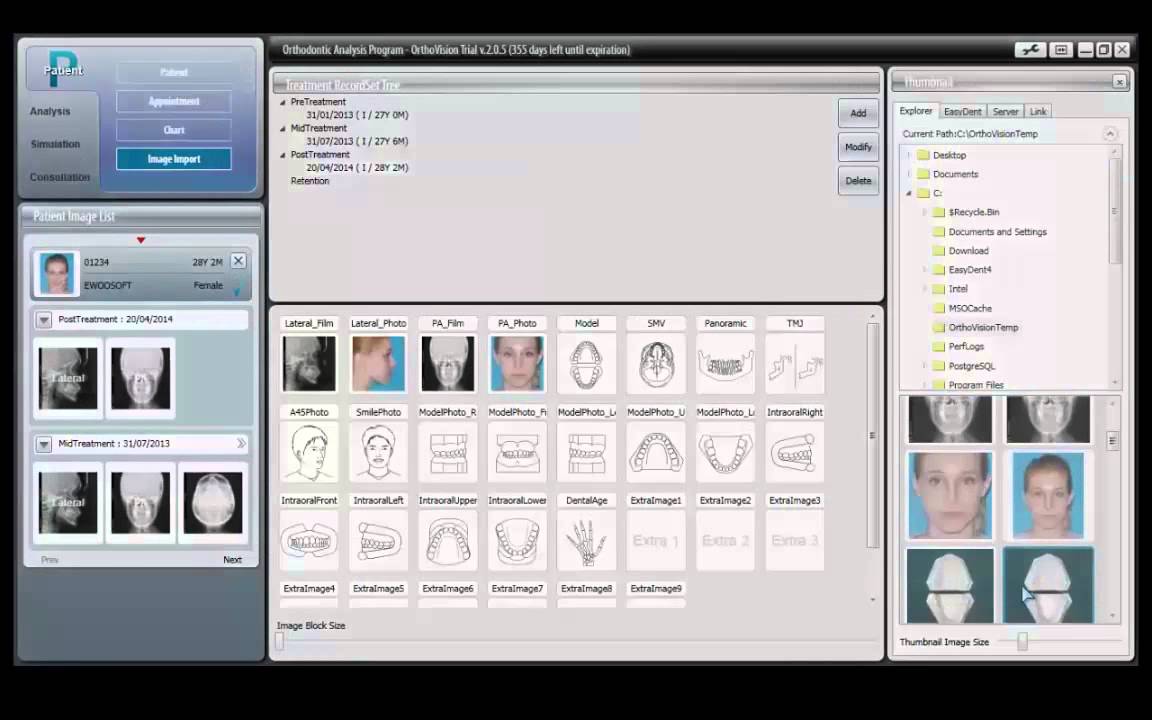 01 Basic Introductory Instructional Tutorial Video For OrthoVision ...