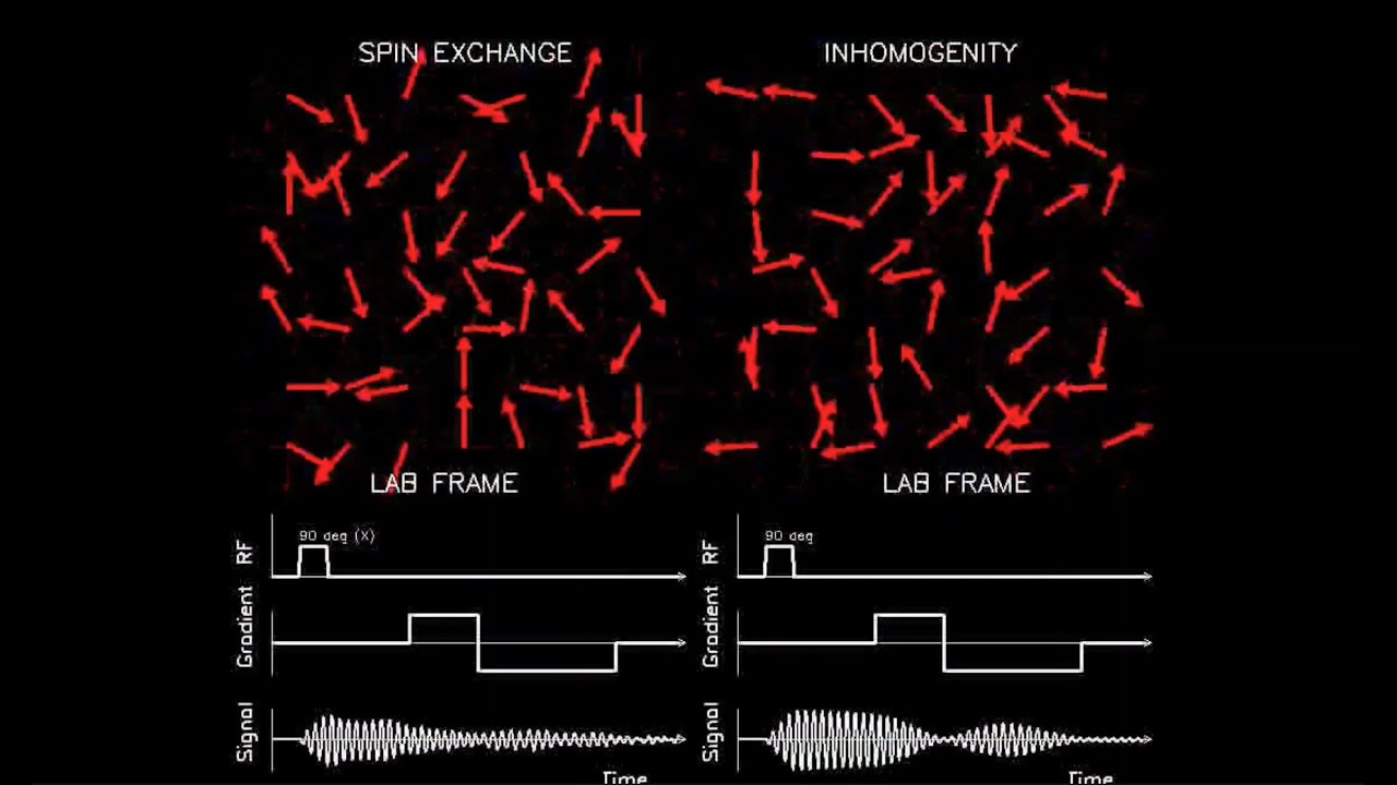 MRI: Physics and Image Creation - Gradient Echo (Part 12/18) - YouTube